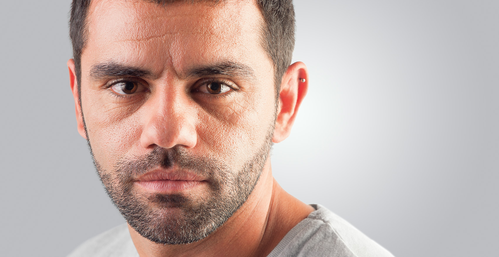 Nasenkorrektur breite Nase / Boxernase | Rhinoplastik im ROZ